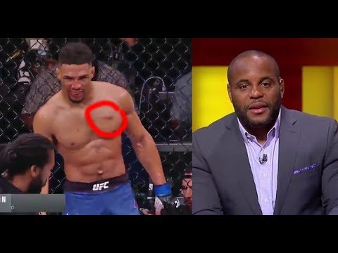 CONTROVERSY!!! 'The UFC Told Us Not to Mention Kevin Lee's Staph In...